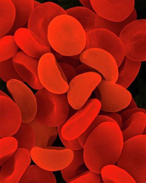 Hypotonic Art Pixels