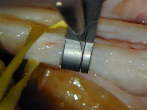 Microanatomy Of The Nerve Pptx