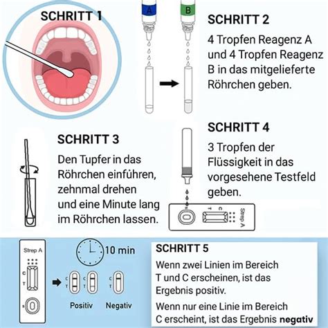 Ergebnisse Des Streptokokken Tests Strep A Selbsttest