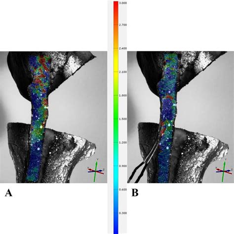Exemplary Strain Map On The Surface Of The Bone−ligament−bone Complex
