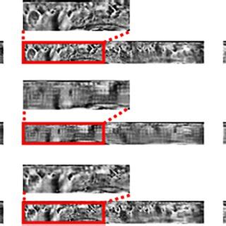 Network Architecture Proposed For Iris Segmentation Download Scientific Diagram