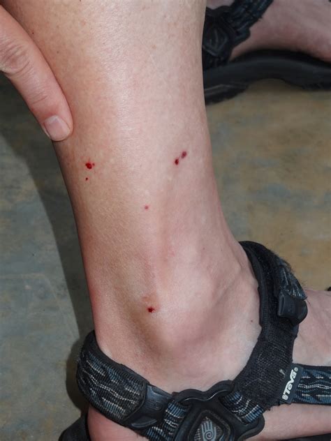 World Travel Marc And Peggy Faucher Leech Zone No Stopping