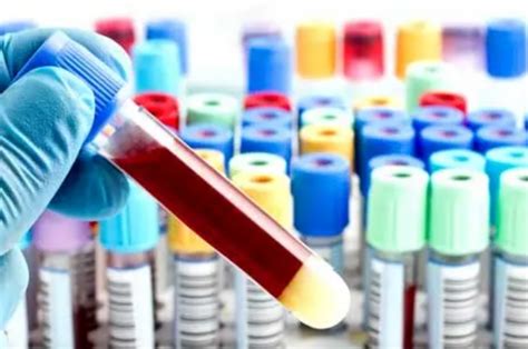 Aerococcus Urinae Lægenoter