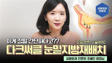 눈밑이 고민이시라면 눈밑지방재배치 다크서클눈밑꺼짐착색하안검스킨부스터 Youtube