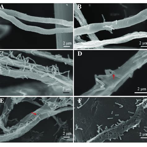 SEM Examination Of The Pythium Hyphae And Lysobacter Cells During