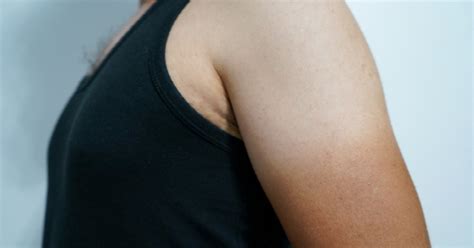 올여름에 검게 탄 피부 겨울 되면 정말 하얗게 돌아올까