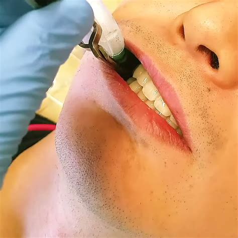 Releaf 1 Ultrasonic Evacuation Suction System In Dentistry Youtube