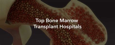 Top 5 Hospitals For Bone Marrow Transplants In India