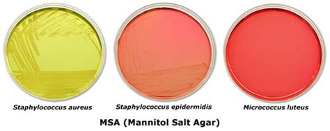 Msa Mannitol Salt Agar Flashcards Quizlet
