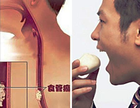 梗噎图册 360百科