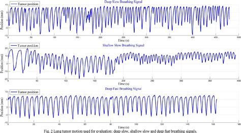 Figure 2 From Motion Prediction Of Lung Tumor Using Predicted Error Based Normalized Least Mean