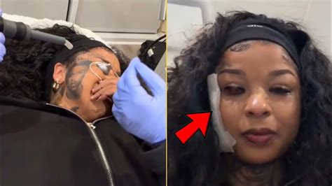 Chrisean Rock Erased Blueface Tattoo From Her Face And Shows Her New