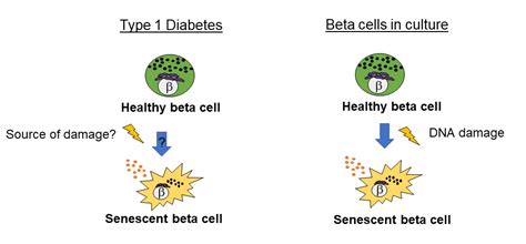 A New Piece Of The Puzzle To Explain How Type 1 Diabetes Occurs And