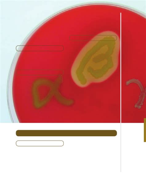 Streptococcus Notes Diagrams And Download Pdf Osmosis