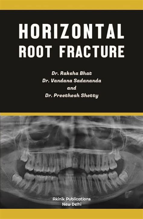Horizontal Root Fracture Akinik Publications