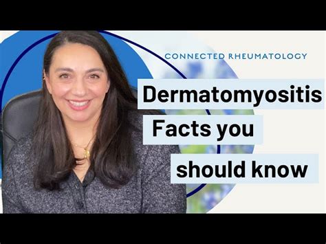 Free Video Dermatomyositis Facts Your Rheumatologist Wants You To Know From Connected