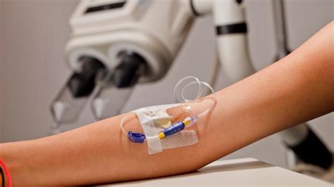 Vascular Access Devices Market Report Global Forecast From 2023 To