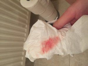 Post Intercourse Secretions Understanding Discharge After Sex Health Research Policy