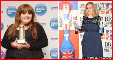 Adele Plastic Surgery Evolution Rhinoplasty Liposuction Celebrities Plastic Surgery