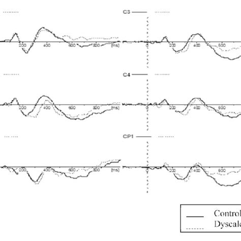 Event Related Potential Erp Difference Waves Of The Control And Download Scientific Diagram