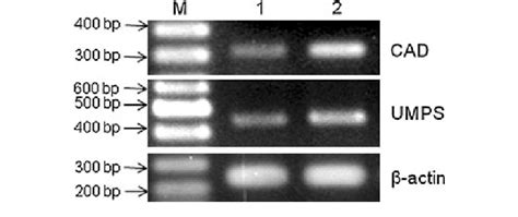 Establishment Of The Presence Of Cad And Ump Synthase Umps Mrnas In