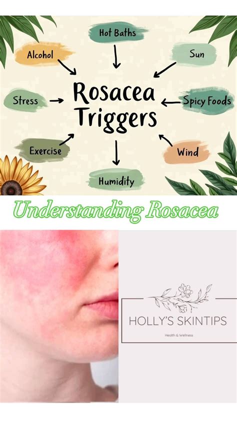 Skin Tips With Holly Skinhealthandwellnesswithholly • Instagram