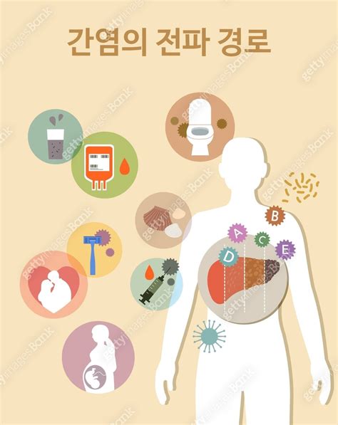 간 인체내부기관 간염 건강관리 주제 질병 전염병 질병 헌혈 치료 주사기 임신 물체묘사 성행위 Sex And Reproduction