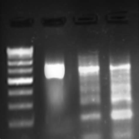 A Typical Ladder Pattern Of Dna Fragmentation 1 1 Kb Dna Ladder 2 Download Scientific