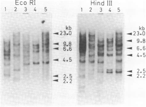Figure 6 From Immunoglobulin Switch Region Like Sequences In Drosophila Melanogaster Semantic