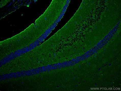 Synaptophysin Antibody 67864 1 Ig Proteintech Synaptophysin Antibody 67864 1 Ig Proteintech