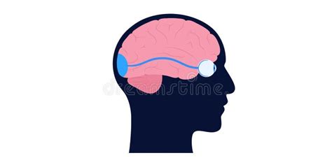 Optic Nerve Anatomy Stock Vector Illustration Of Neurology 324839441