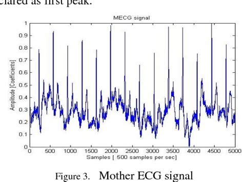Figure 3 From Fetal Ecg Extraction Using Wavelet Transform Semantic