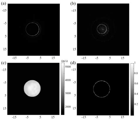 Dynamic Speed Of Sound Adaptive Transmissionreflection Ultrasound Computed Tomography