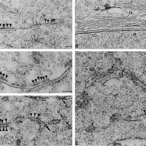 Higher Magnification Transmission Electron Micrograph Sections Stained