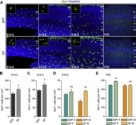Microbiome Influences Prenatal And Adult Microglia In A Sex Specific