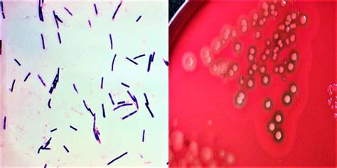 Clostridium Perfringens Colony