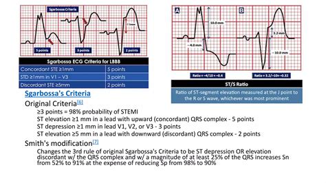 Stemi Equivalent Pptx