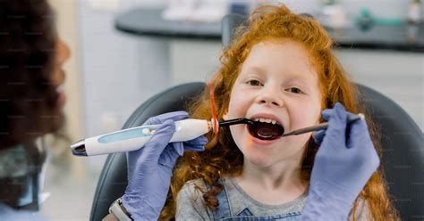 치과 의사 사무실에서 치과 치료를 받는 작은 빨간 머리 소녀 환자의 모습을 닫습니다 경화 중합 Uv 램프를 사용하여 충전물로