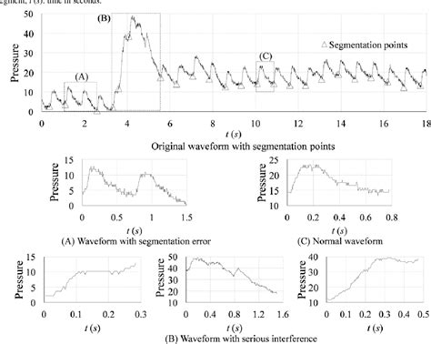Figure 1 From Machine Learning Based Signal Quality Evaluation Of