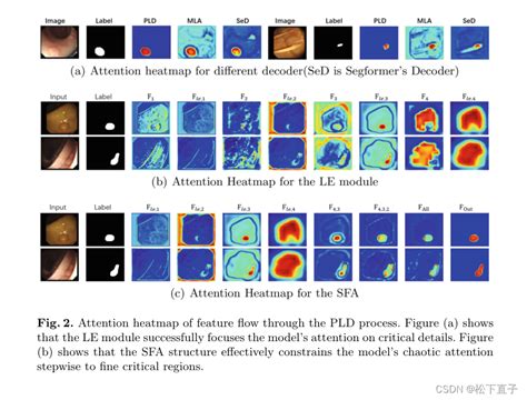 Stepwise Feature Fusion Local Guides Globalssformer Csdn博客