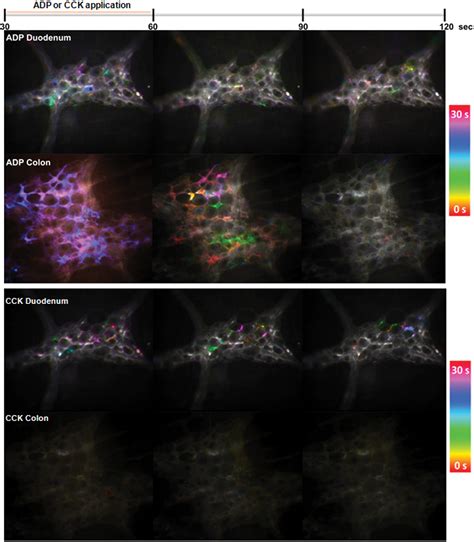Figure 11 From Functional Intraregional And Interregional Heterogeneity