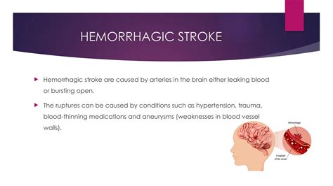 Stroke Powerpoint Presentation Definition Types Ppt