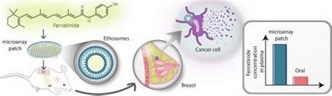 Novel Lipid Nanovesicle Loaded Dissolving Microarray Patches For Fenretinide In Breast Cancer