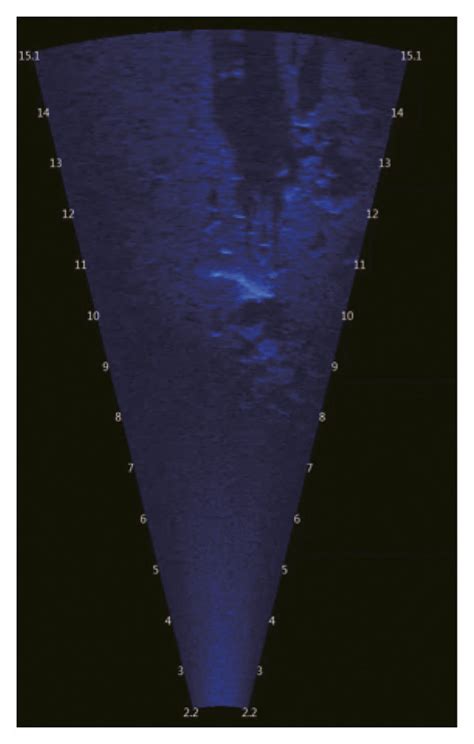 Sonar Images Of Divers With Various Shapes And Intensity Features Download Scientific Diagram