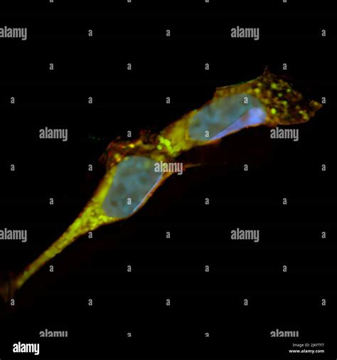 Mutations In The Lrrk2 Gene Have Been Linked To About Three Percent Of