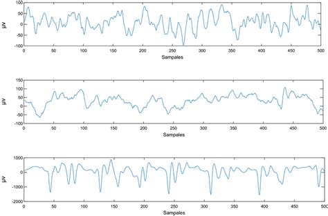 Exemplary Typical Eeg Signals Of The Sets Class Z O Class N F Download Scientific