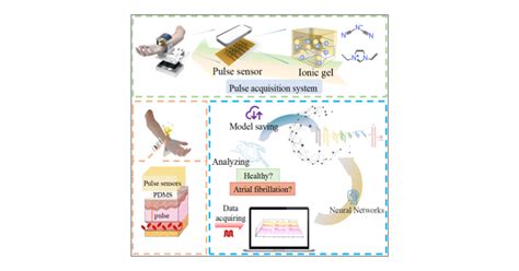Artificial Intelligence Enabled Novel Atrial Fibrillation Diagnosis