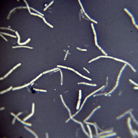 Negative Staining Principle Procedure And Result 54 Off