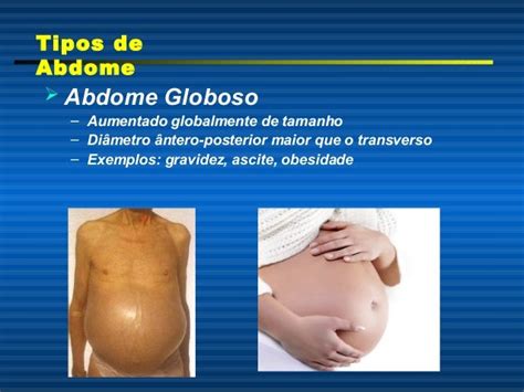 Aula Sobre Semiologia Do Aparelho Digestivo