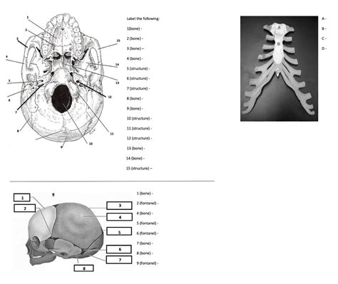 Solved In Lab Study Guide Axial Skeleton Lab Below Chegg